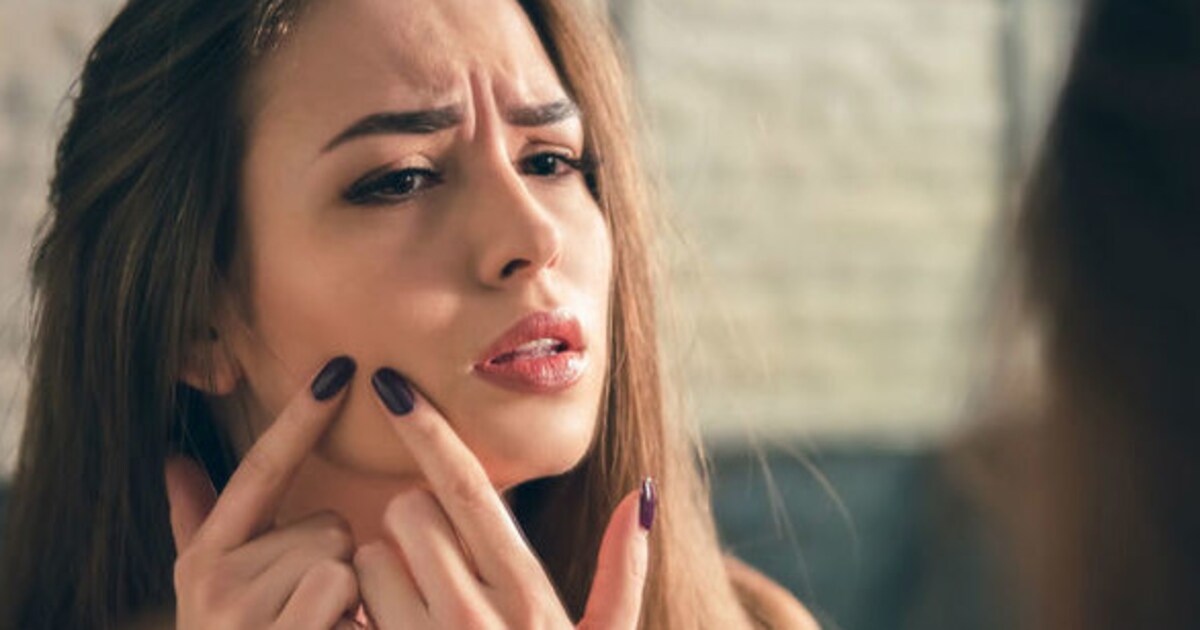 Dol op het uitknijpen van puisten? Hier komt het door | Flair