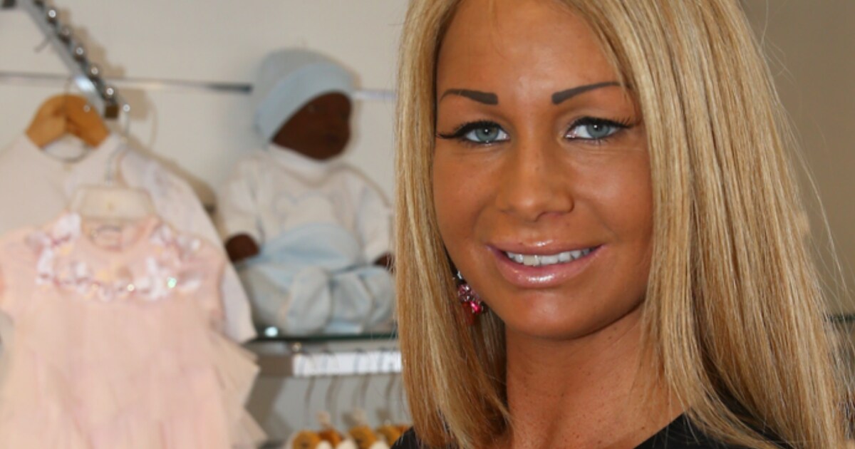 Nieuwe vriend van Barbie heeft zijn lippen laten opspuiten en dit het ...