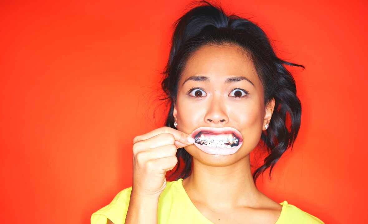 Maartje (31) is eindelijk verlost van haar lelijke gebit | Flair