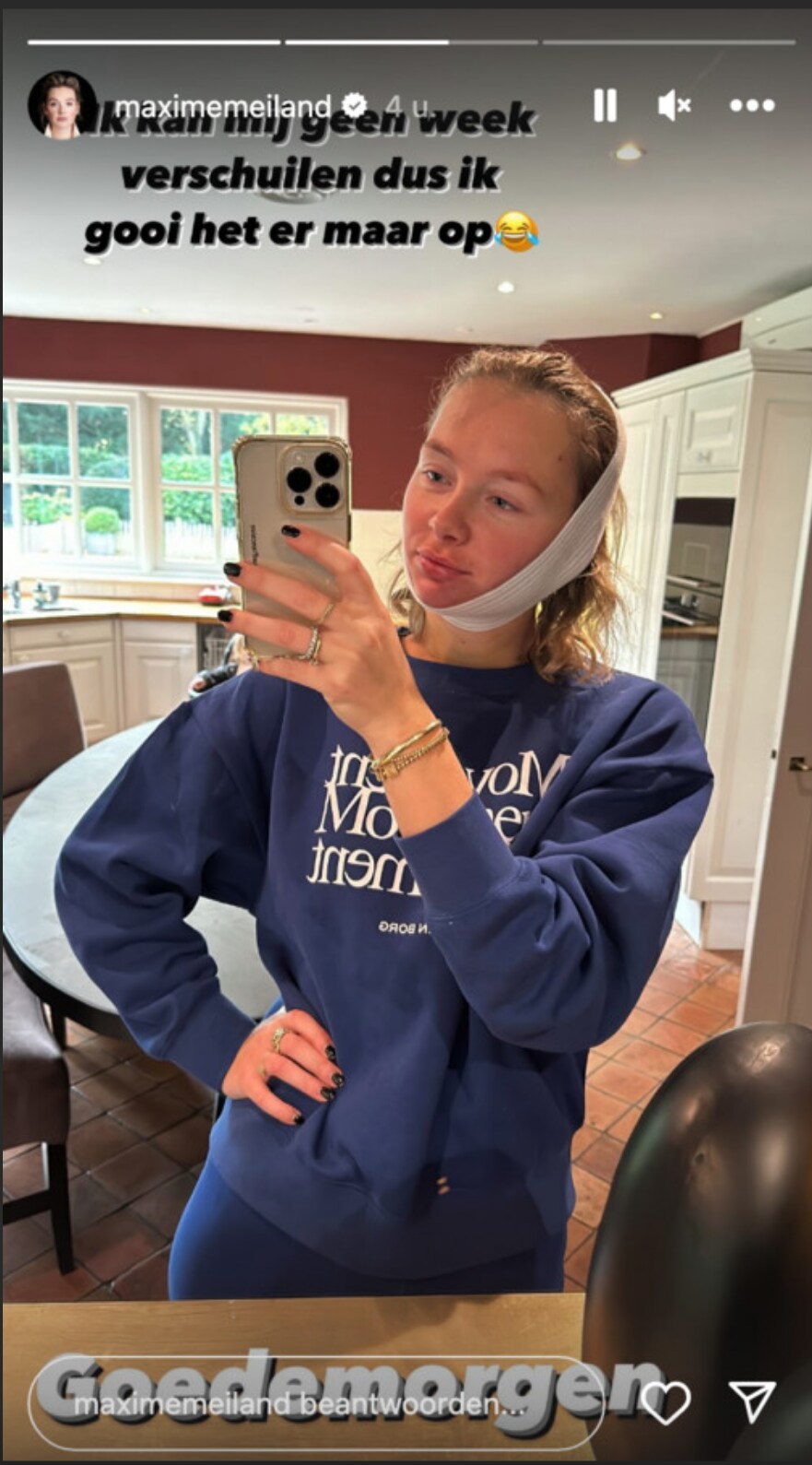 Maxime Meiland in het verband op Instagram: Ik was het zat | Flair