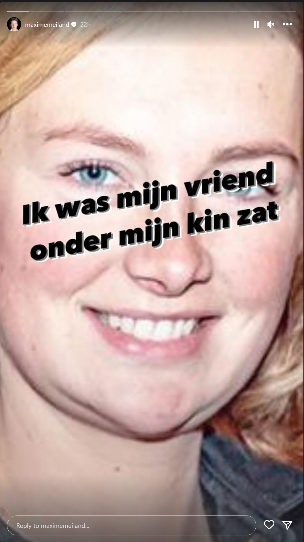 Maxime Meiland in het verband op Instagram: Ik was het zat | Flair